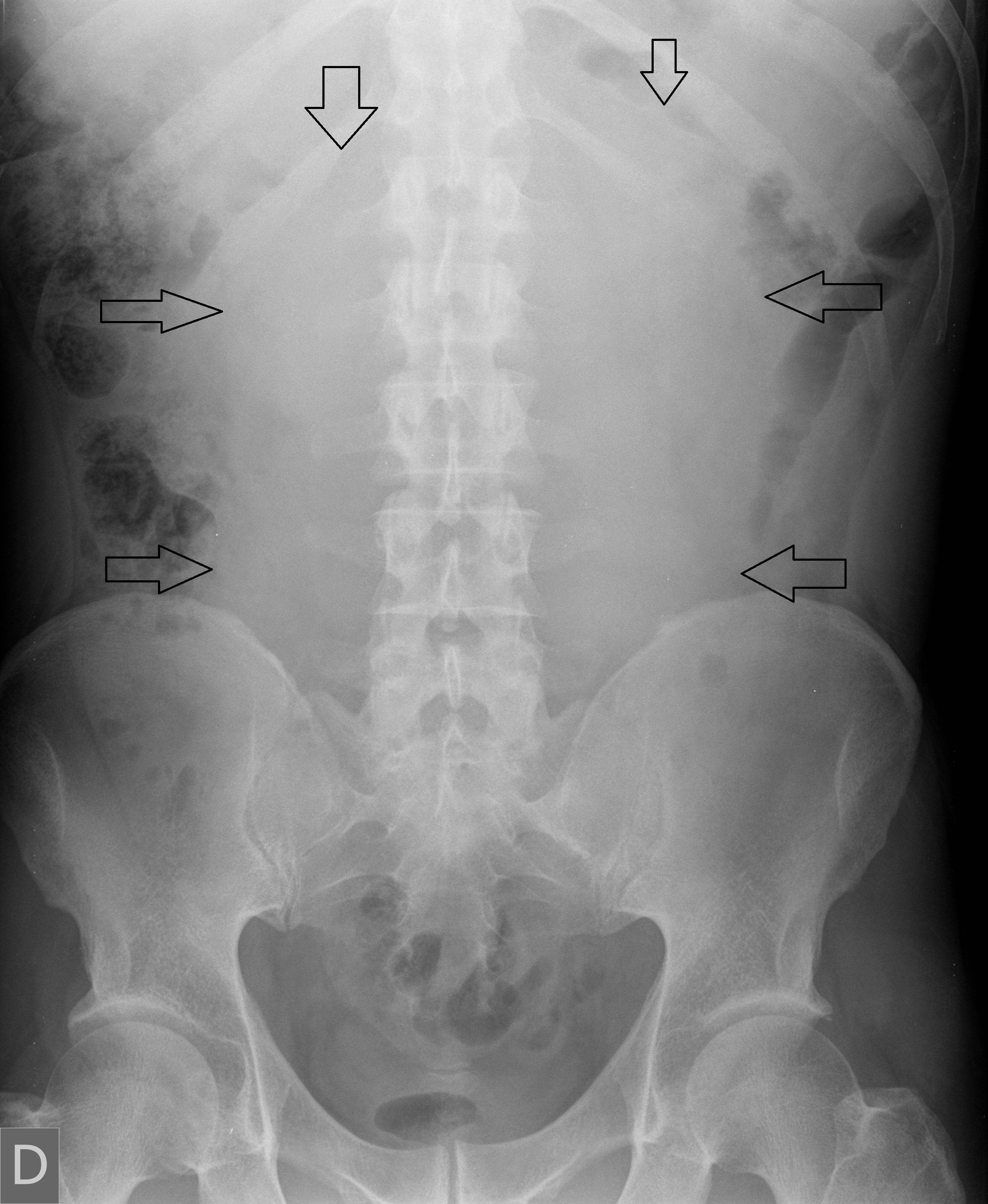 Radiología para estudiantes