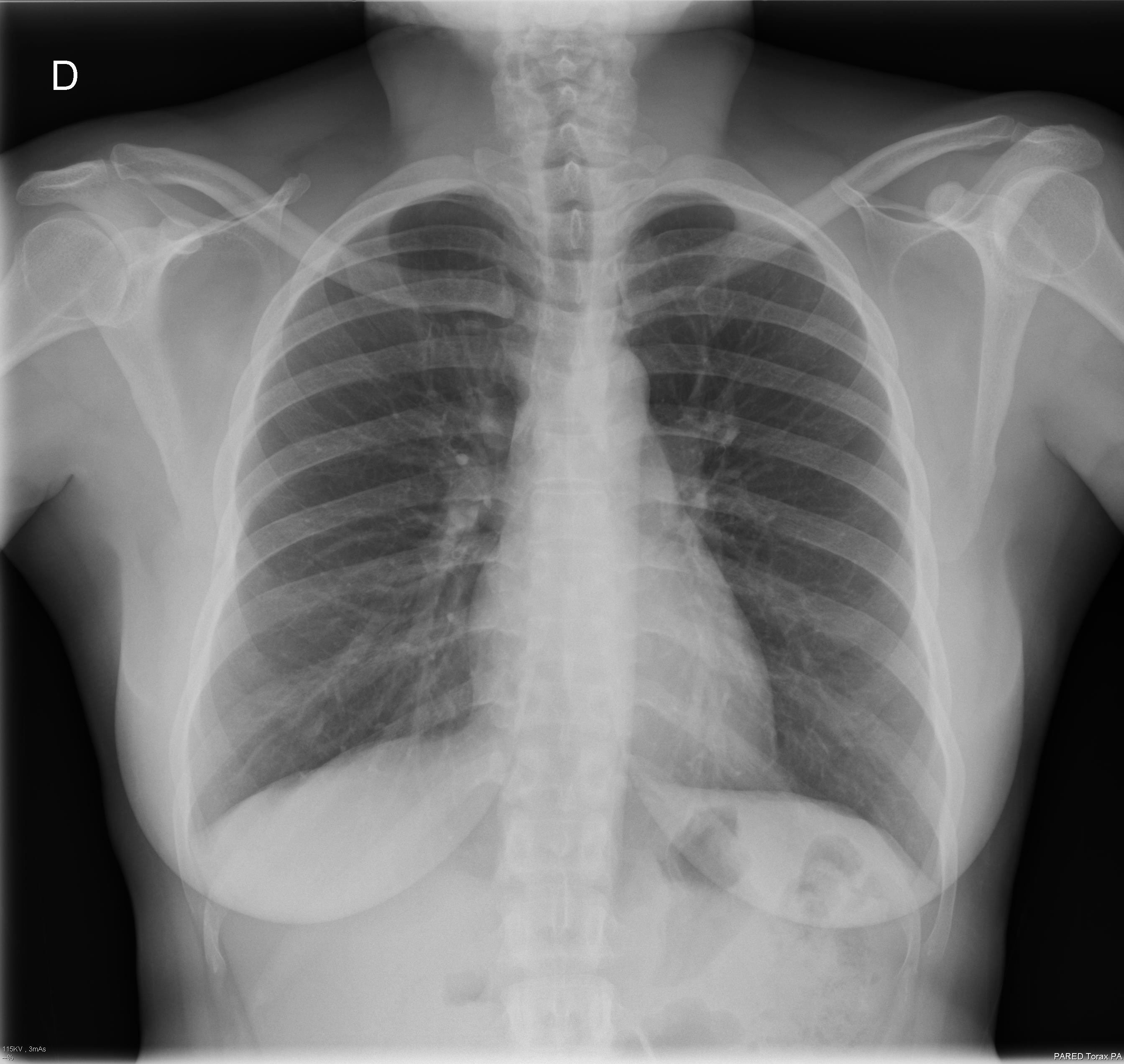 Radiología para estudiantes